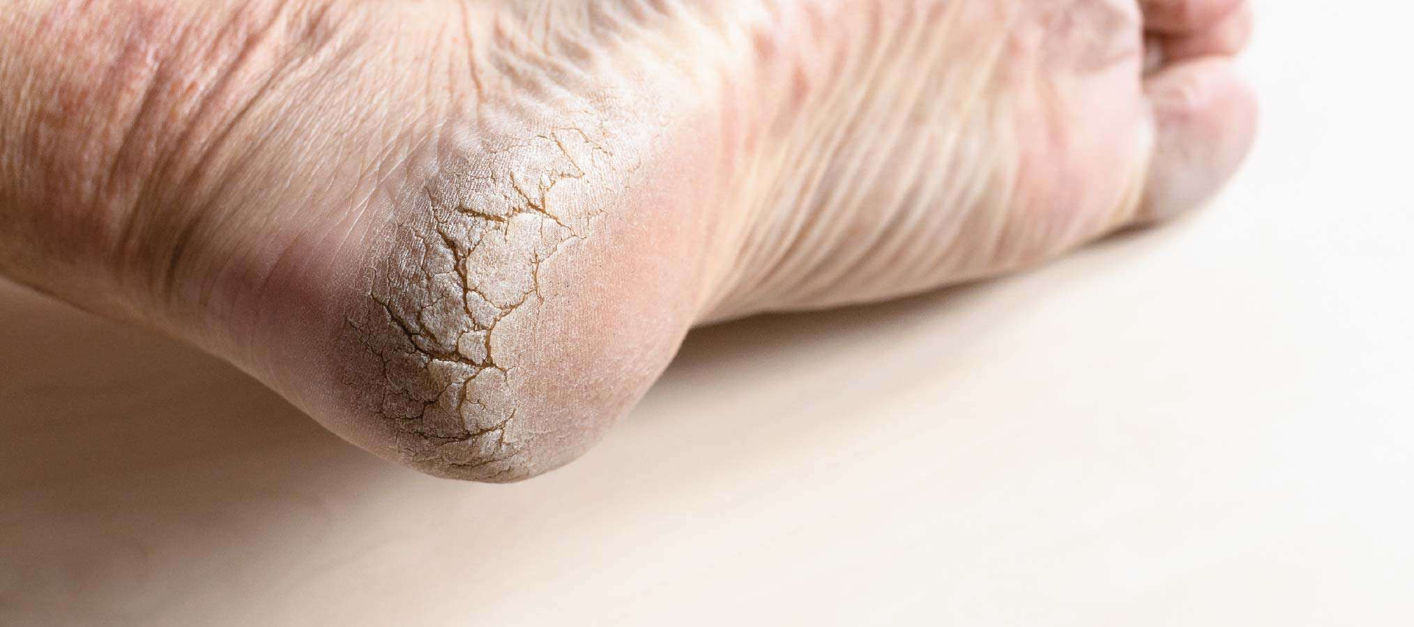 Dry those feet - Foot Doctor | Doctor of Podiatry | Norwalk Podiatrist